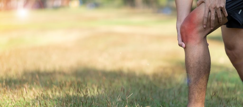 Five Common Soft Tissue Injuries Caused by Accidents or Overuse